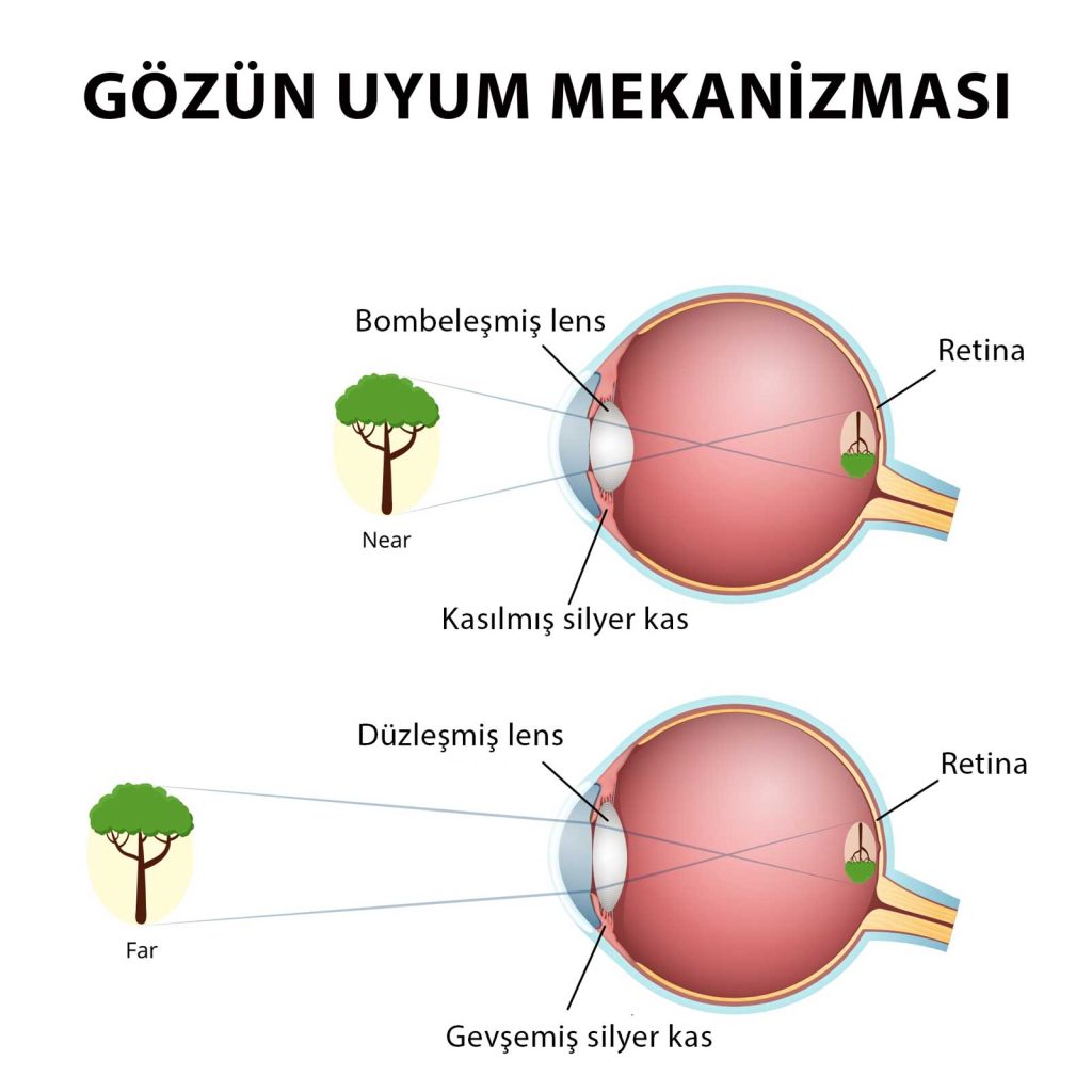 Hipermetropi - Doç. Dr. Fatih Çakır Gündoğan - Kayseri